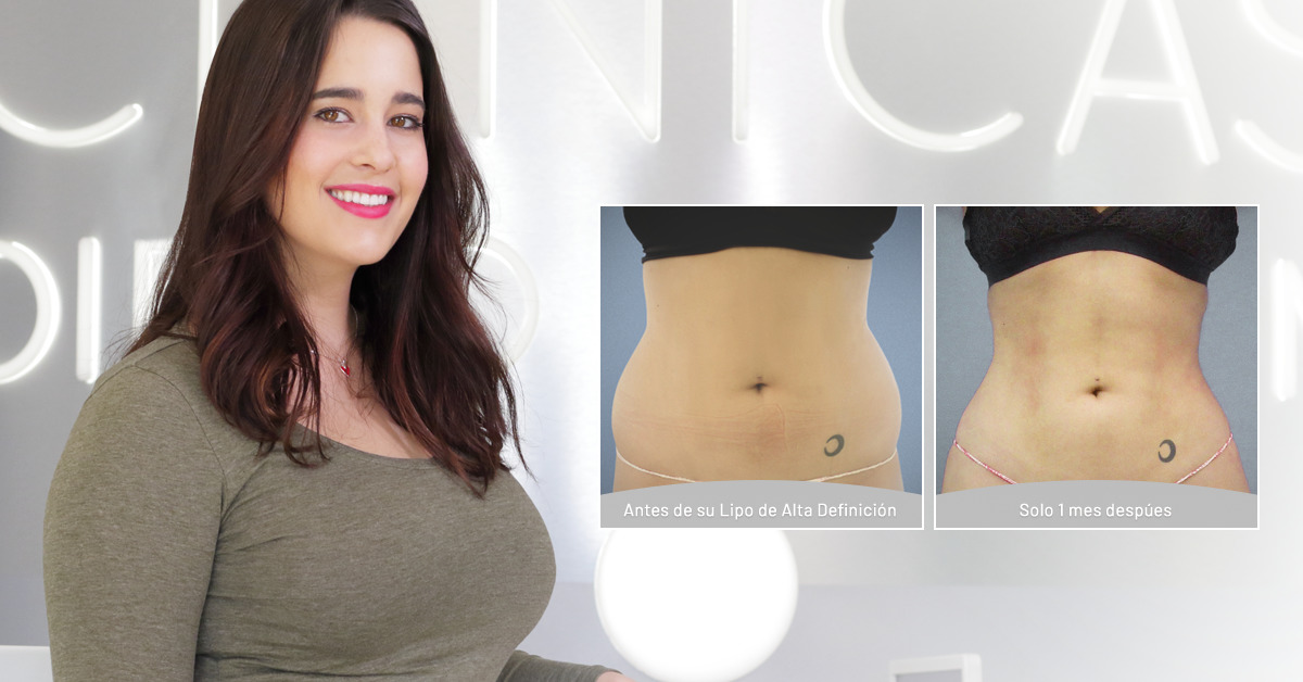Lipo Alta Definición: Técnica Vaser | Clínicas Diego de León